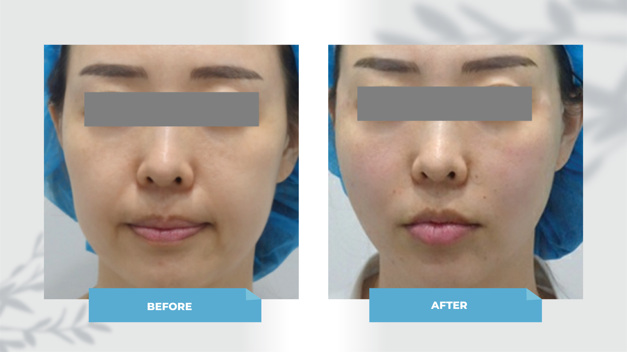 10 Cara Membentuk Garis Rahang Tegas dengan Mudah - Croquis